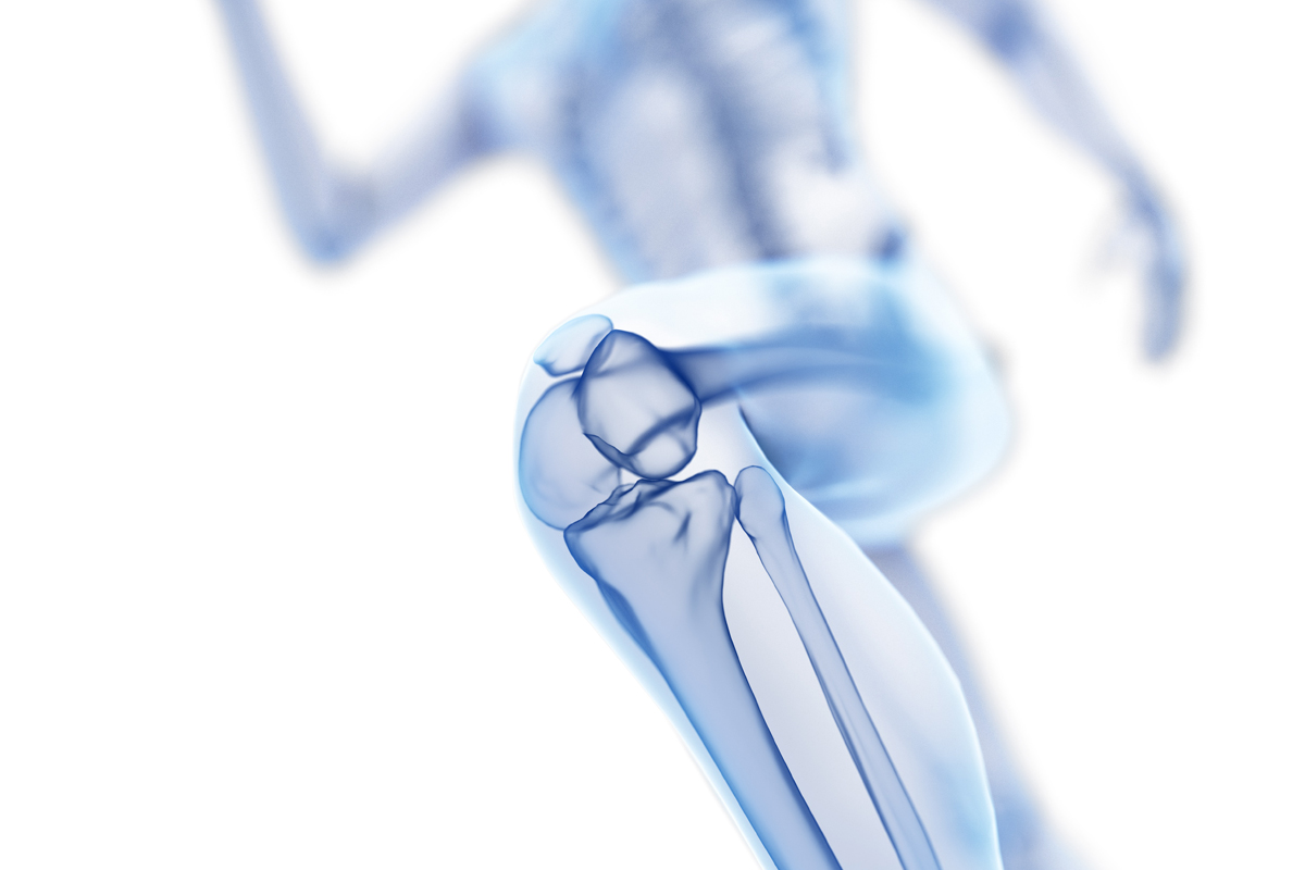 Having the Bone Health Talk With Clients - IDEA Health & Fitness ...